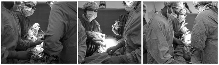 Pregnant with Triplets: A Realistic Look at Triplet Pregnancy and ...