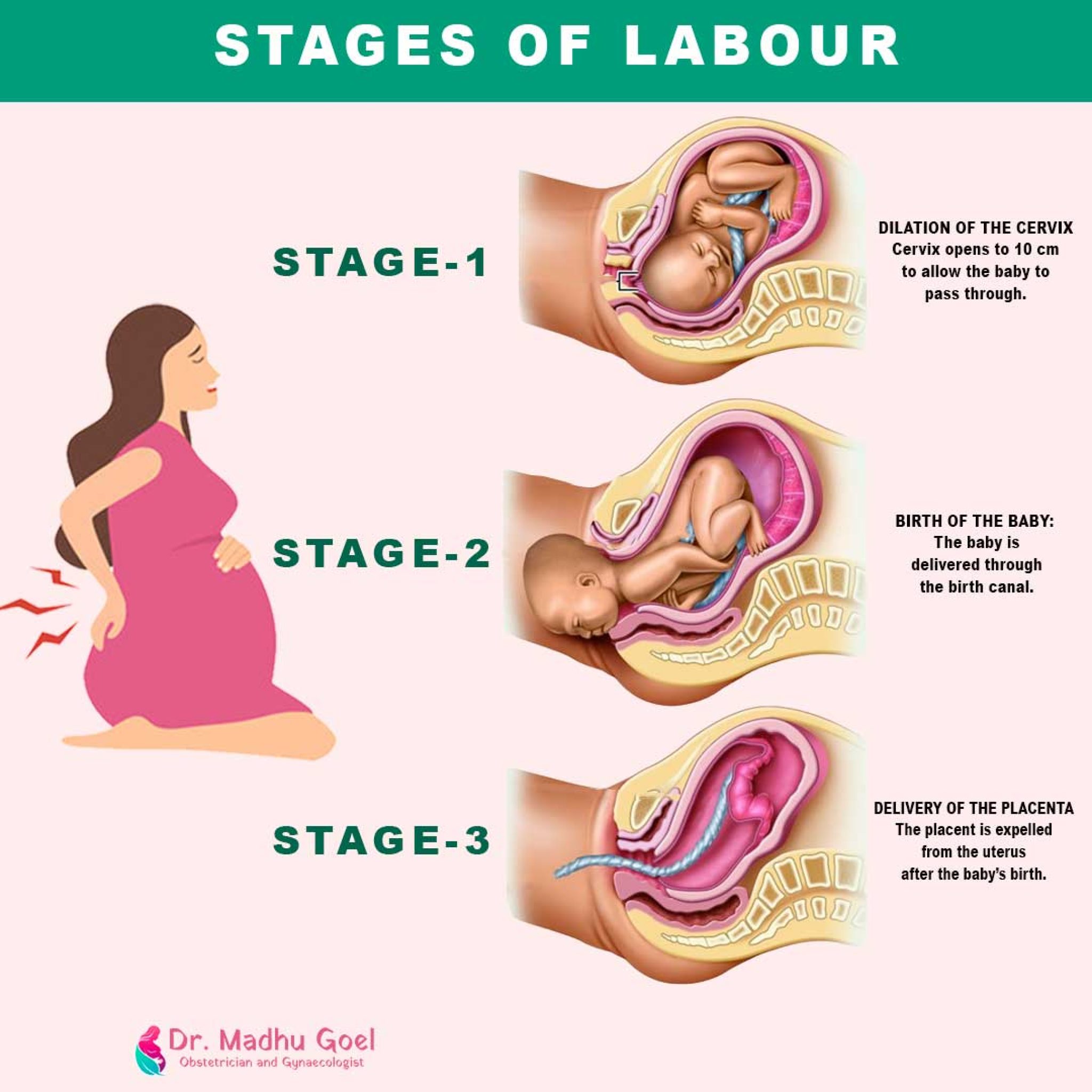 The 3 Stages of Labour: Your Body's Incredible Journey to Motherhood - Dr. Madhu Goel