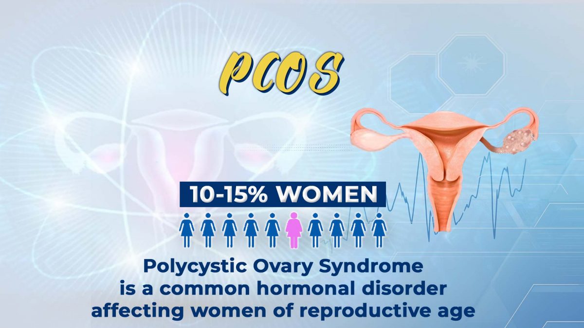 PCOS Causes Explained: From Hormonal Imbalance to Insulin Resistance ...