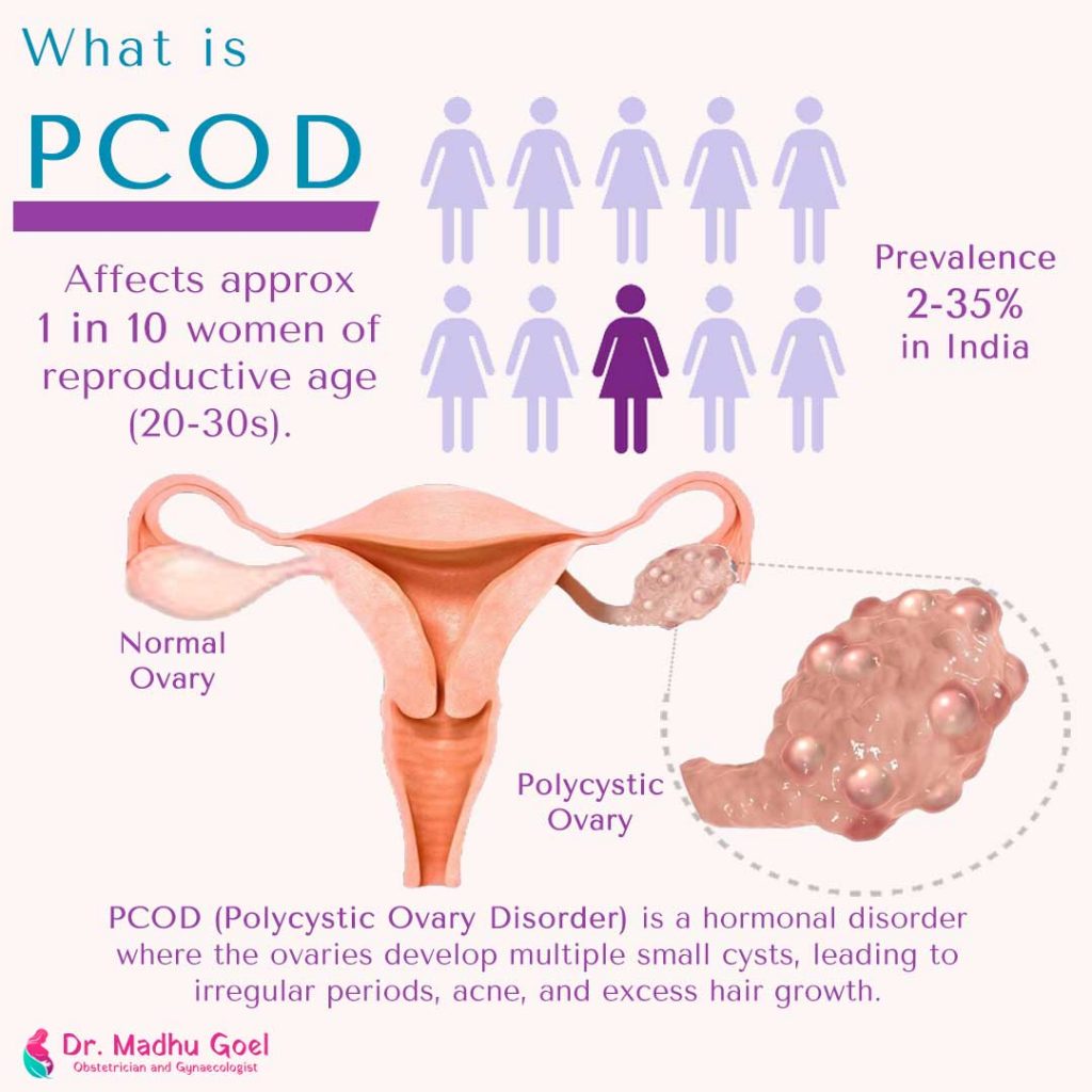 Decoding the PCOD Diagnosis: Understanding Tests and Evaluations - Dr ...